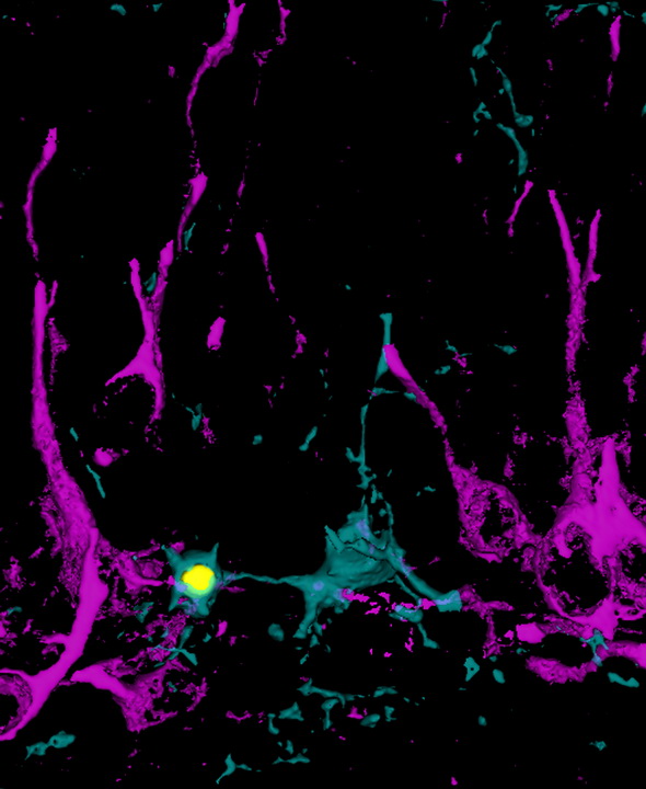 Life after (neuronal) death - Achucarro Basque Center for Neuroscience