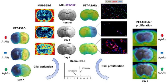 Theranostic potential of adenosine A1 receptors after stroke ...